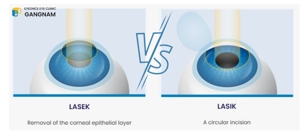 CLEAR LASIK: THE MODERN WAY TO ACHIEVE A CLEARER AND MORE VIBRANT ...