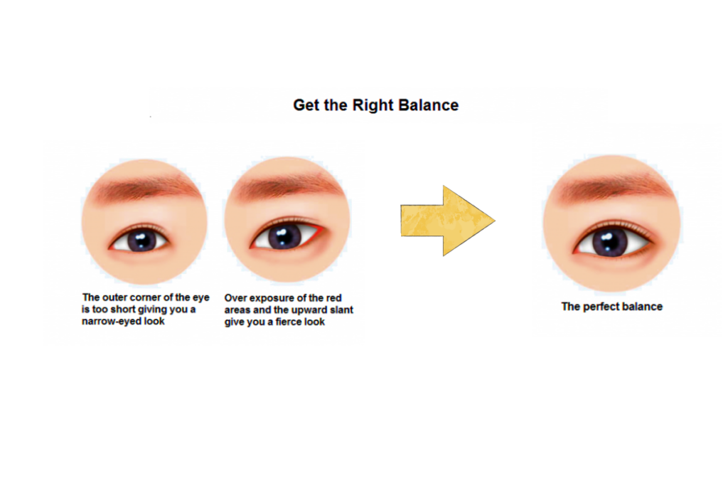 EYE SURGERY - Eyeonce Eye Clinic